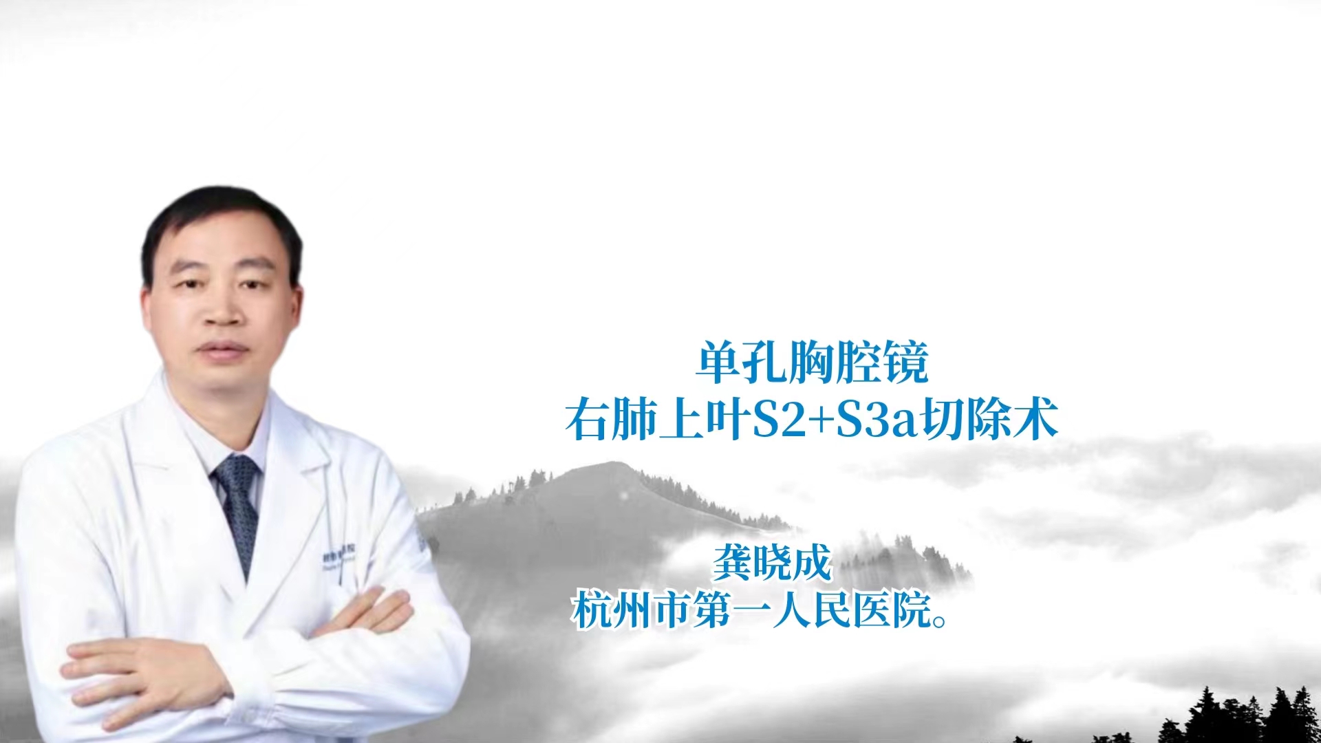 单孔胸腔镜右肺上叶S2+S3 a的切除术