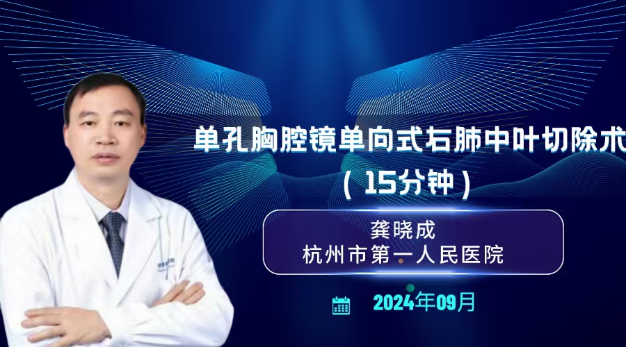 龚晓成 单孔胸腔镜单向式右肺中叶切除术(15分钟)